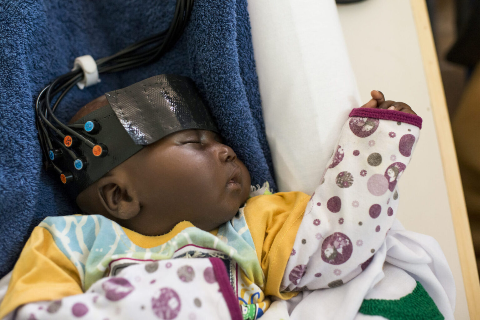 Global fNIRS – Brain Imaging for Global Health